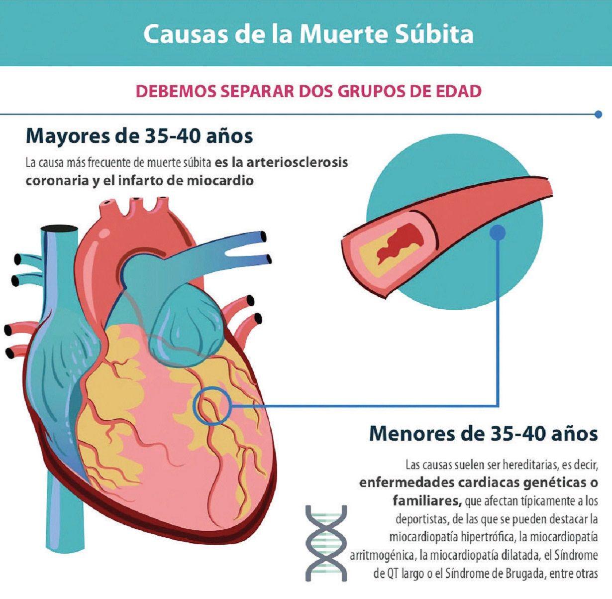 Alarma: se produce más de una muerte súbita cada 15 minutos en la ...