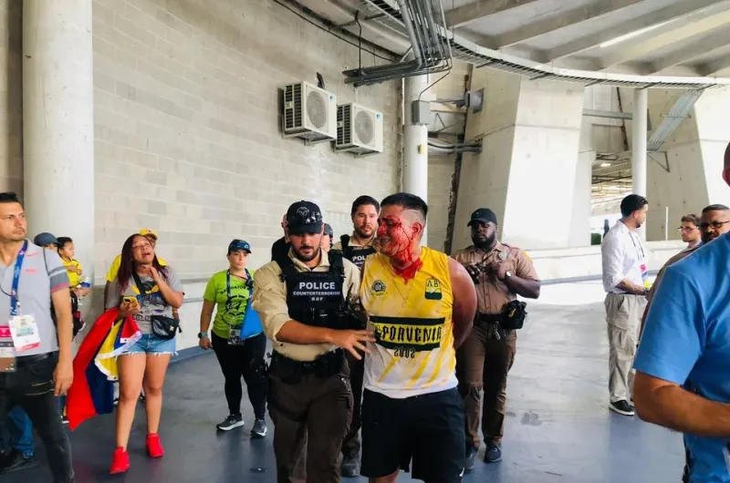 VIDEO | Violencia, sangre y arrestos en la final de la Copa América - Decenas de personas ...
