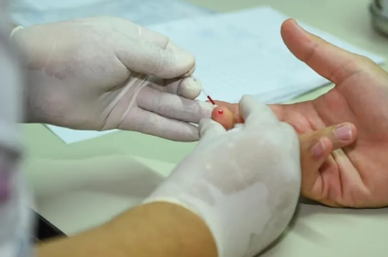 Alerta sanitaria: los casos de sífilis crecieron un 26% en Argentina ...